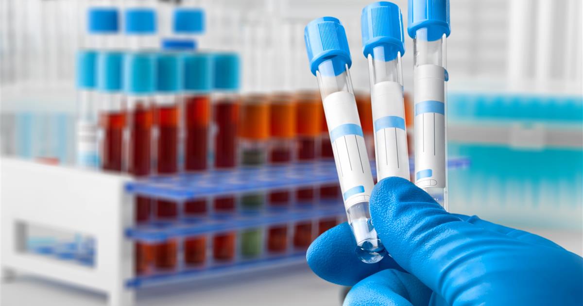 10 Laboratory Labels Vital for Testing and Patient Care | RRD